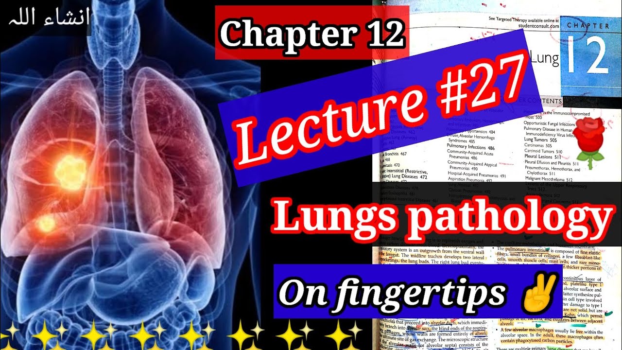 respiratory pathology lecture 27. Granulomatous disease of lungs ...