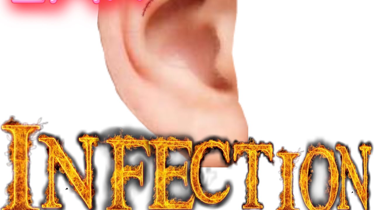 MY EAR INFECTION - YouTube