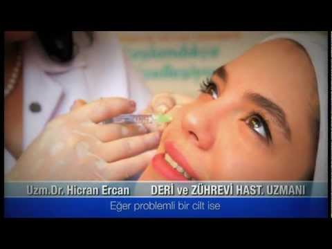 Mezolifting Nedir ?