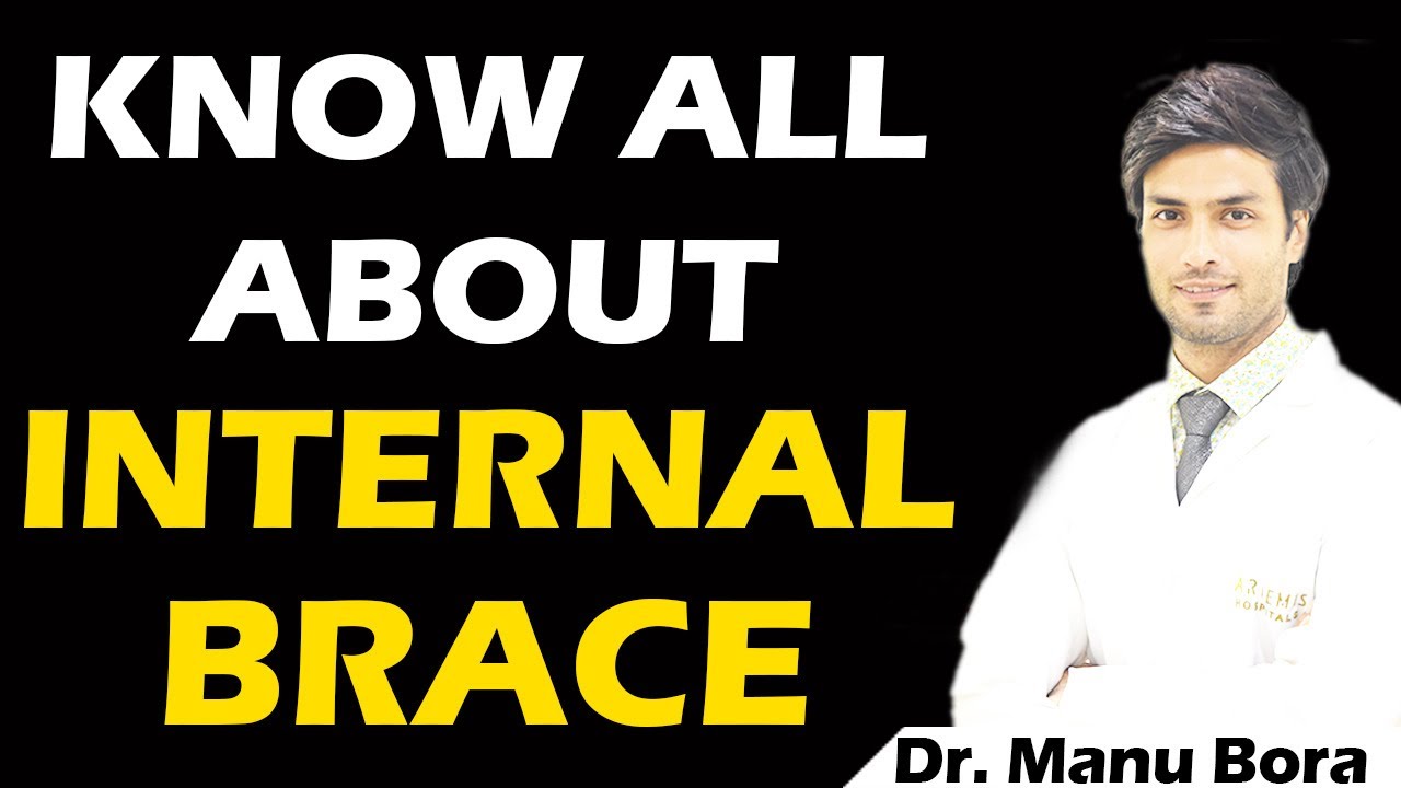 Know All About Internal Brace Dr Manu Bora - YouTube