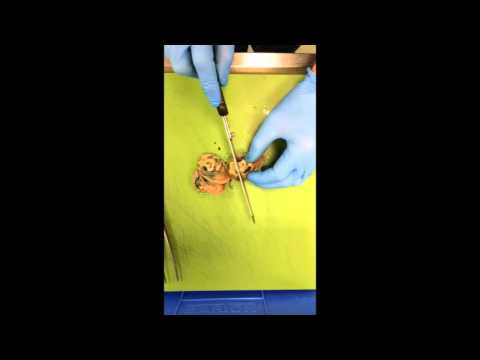 Partial penectomy cut up - YouTube