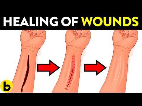 How Does Your Body Heal Cuts & Wounds? - YouTube
