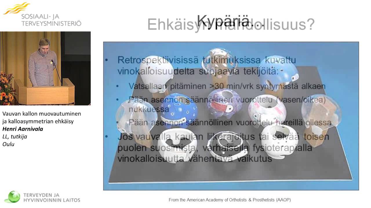 Vauvan kallon muovautuminen ja kalloasymmetrian ehkäisy - YouTube