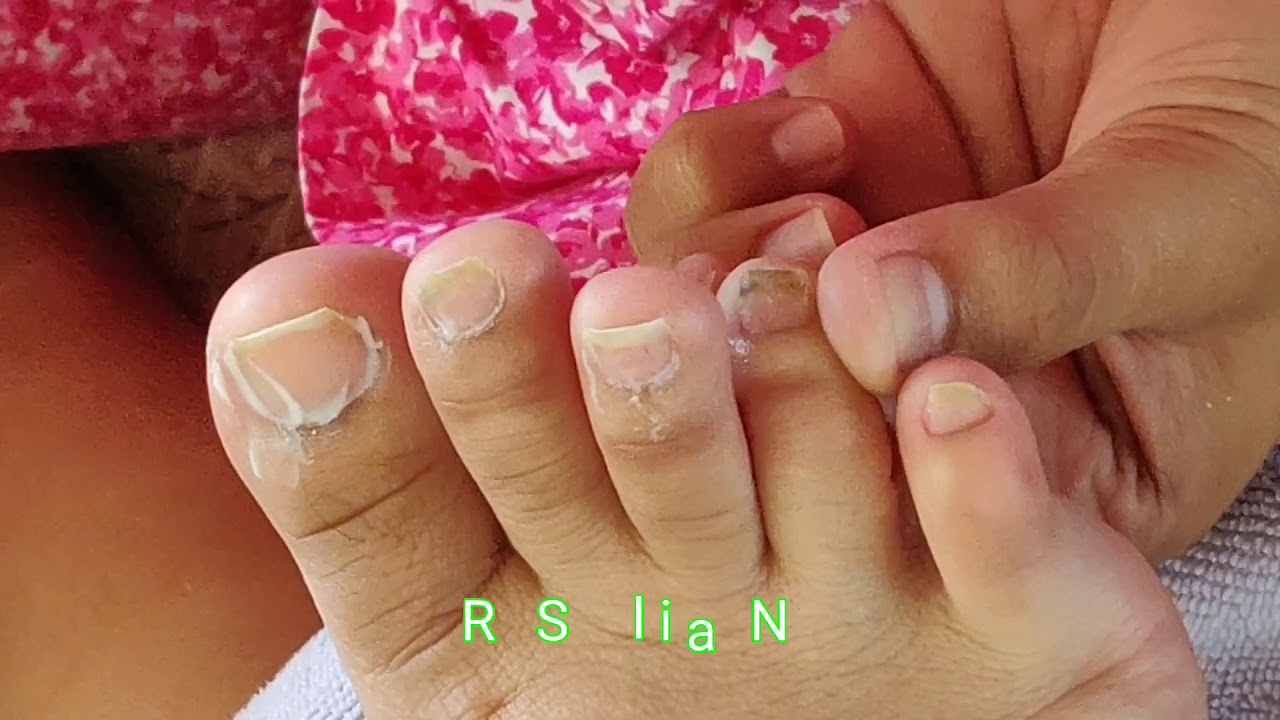 Tips To Cut Toe Nails And Nail Polish - Video Clean Teo Nails EP23 ...