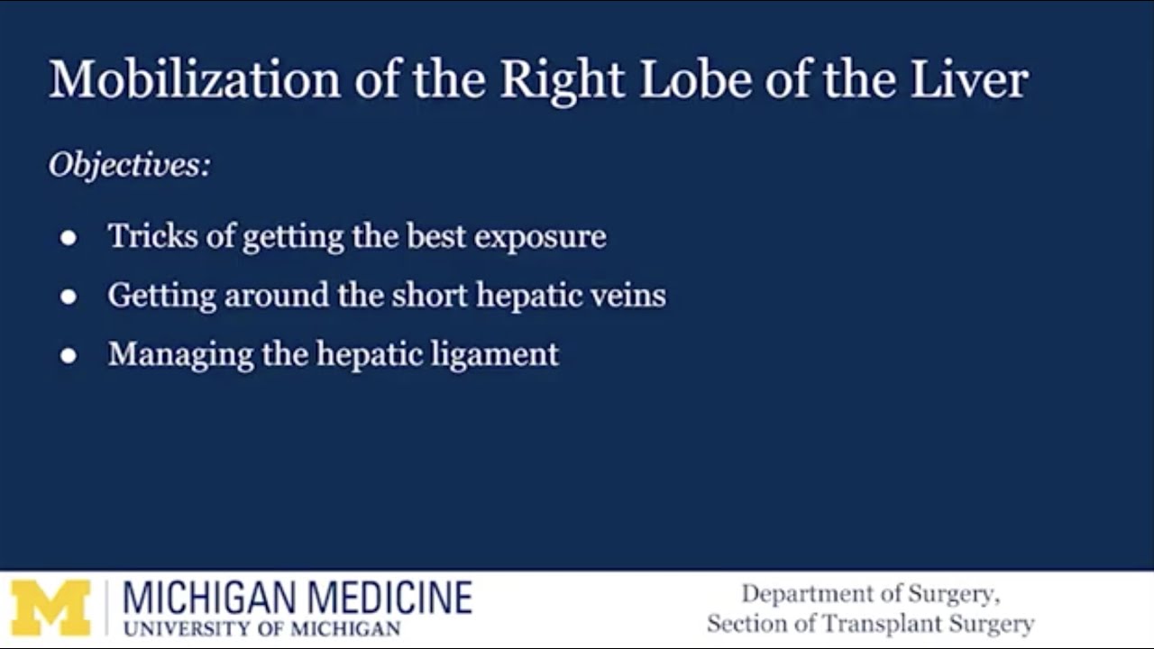 Right Liver Mobilization - YouTube