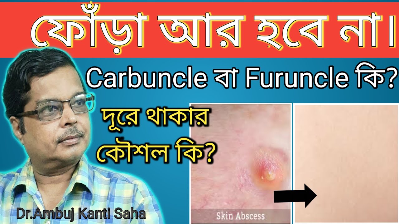 Skin Abscess, Causes, Signs and Symptoms, Diagnosis and Treatment ...