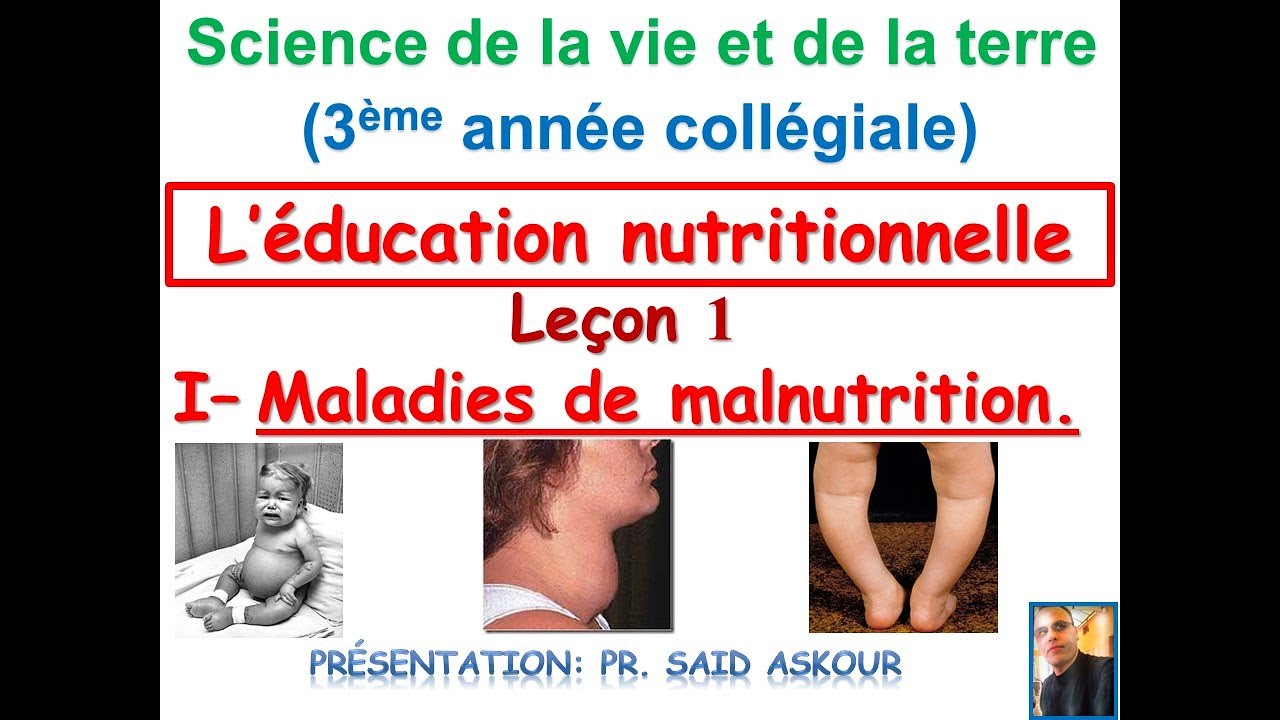 Les maladies de malnutrition (Carences alimentaires) - YouTube