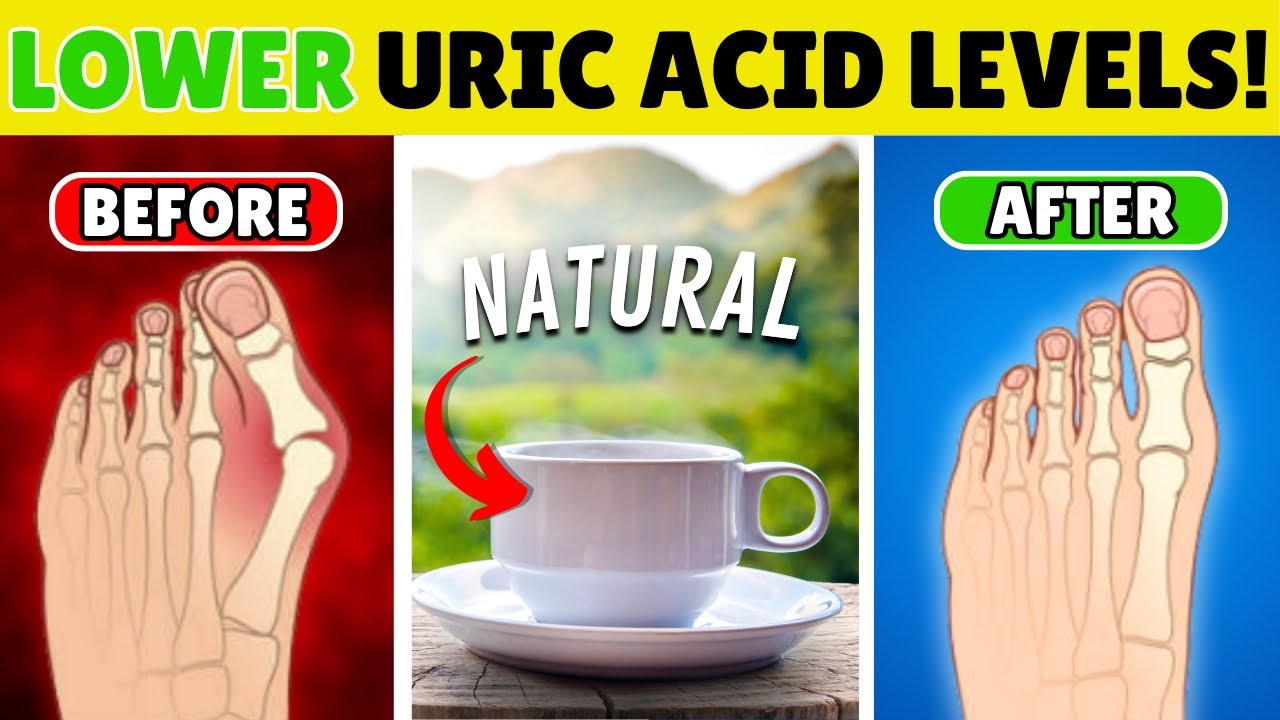 Treat Gout and Lower Uric Acid Levels With 12 SIMPLE Drinks! - YouTube