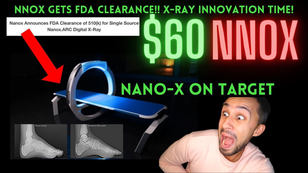 NNOX just got FDA CLEARANCE! Will the stock BOOM next week? nnox stock ...