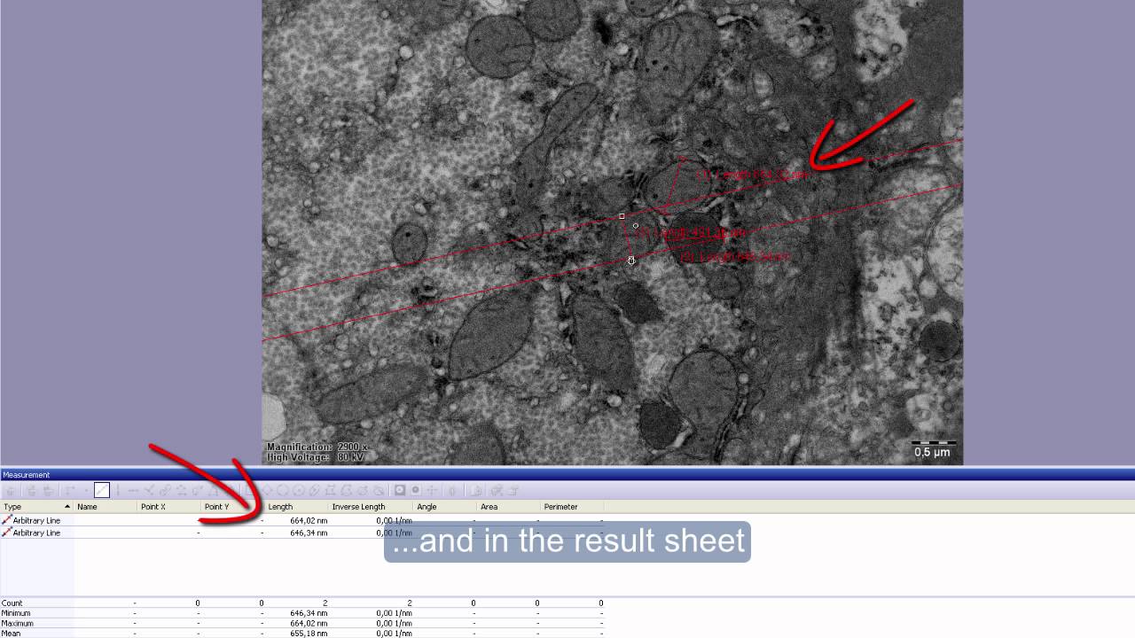 Interactive Measurement with RADIUS - YouTube