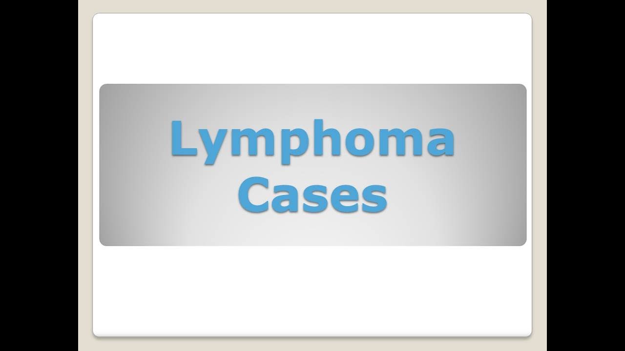 Lymphoma Cases v2 - YouTube