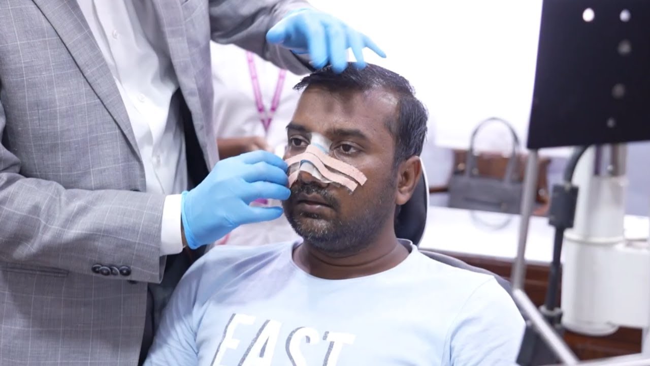 SPLINT Removal After Nose Plastic Surgery - YouTube