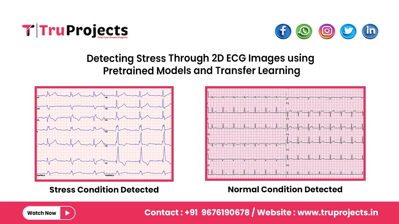 Detecting stress through 2D ECG images using pretrained models and ...