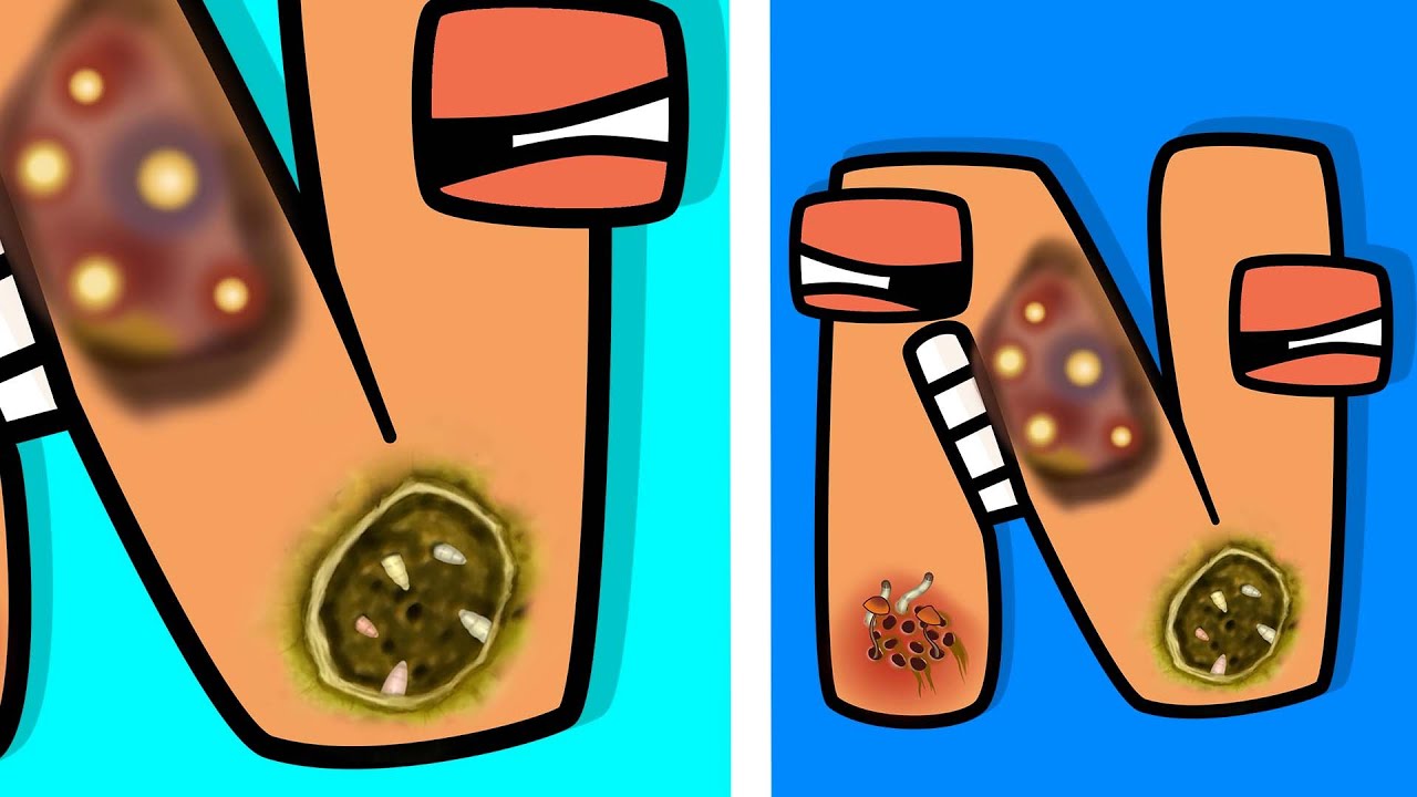 Alphabet lore | Alphabet lore N and therapeutic journey for alphabet ...