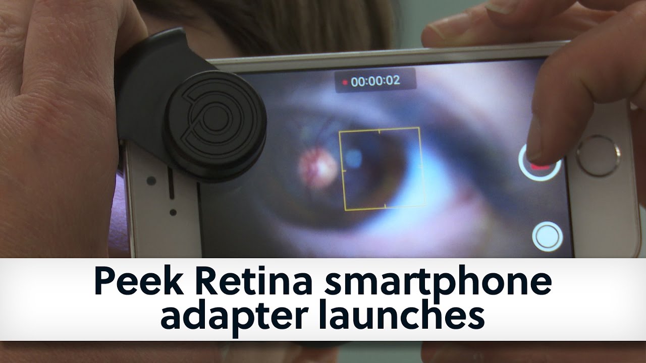 Peek Retina smartphone adapter launches - YouTube