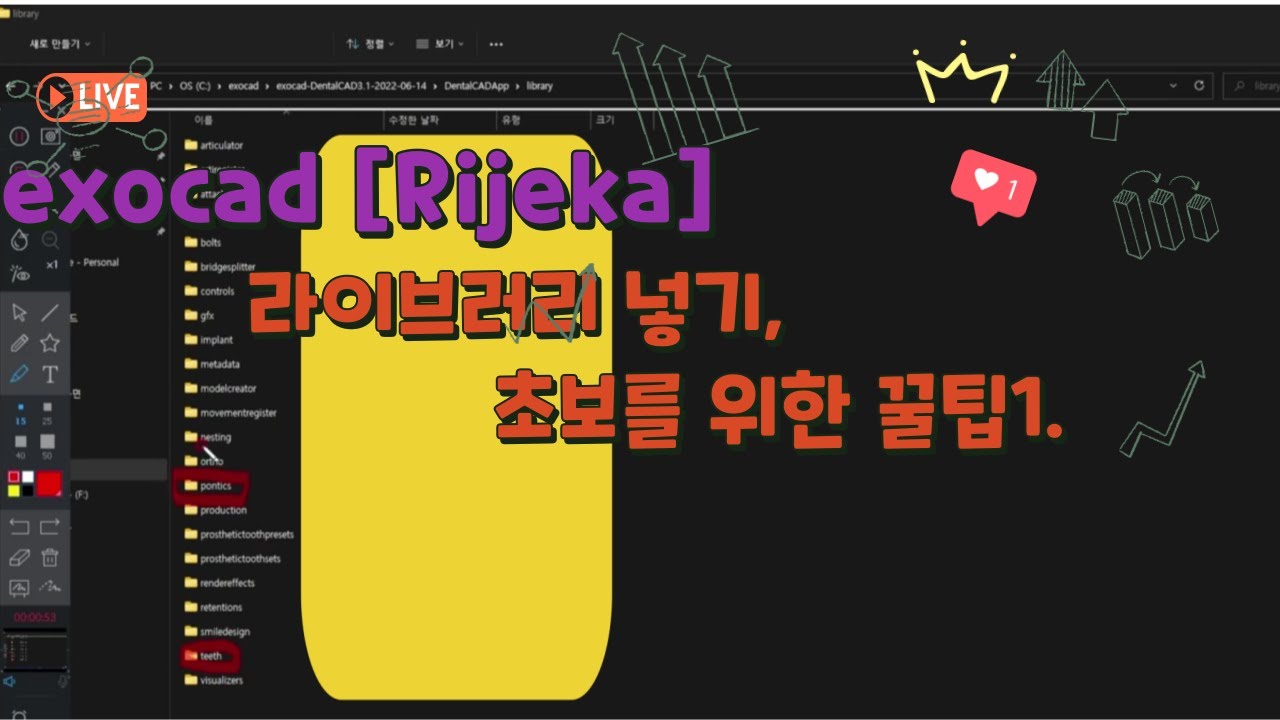 how to add implant library in exocad.exocad library. 초보자를 위한 라이브러리 넣는 ...
