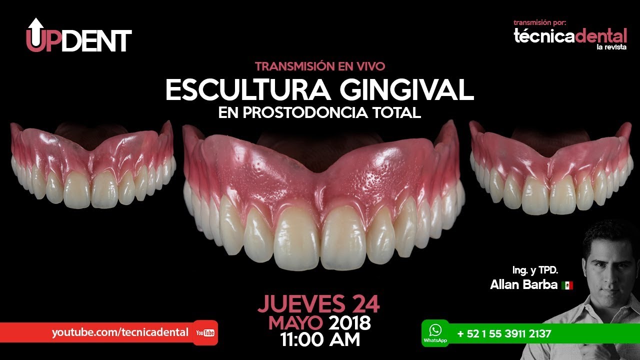 Escultura Gingival en Prostodoncia Total - YouTube