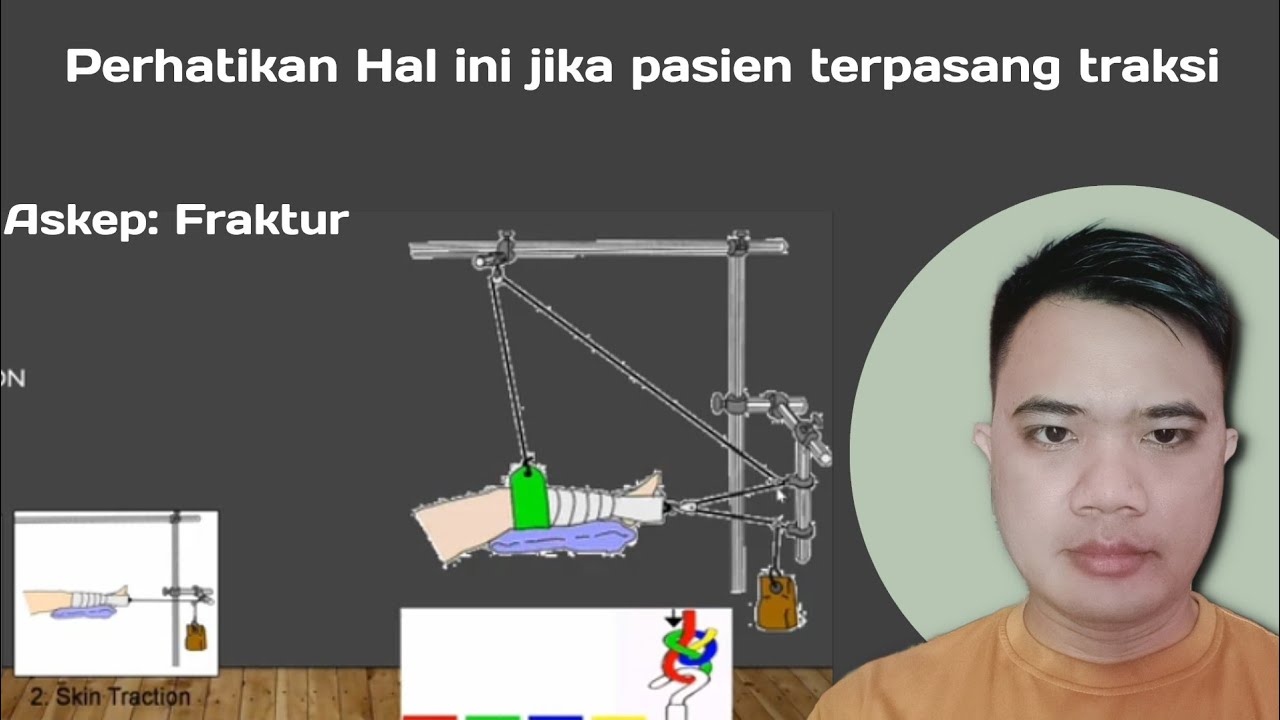 ASKEP FRAKTURE/TRAKSI/SKIN TRAKSI/SKELETAL TRAKSI/NURSING CARE PLAN ...