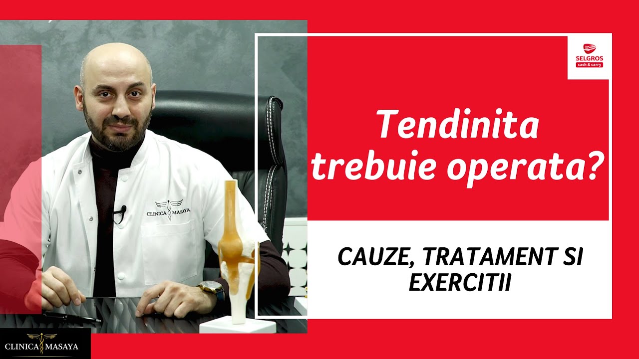 Tendinita: Tratament si 2 Exercitii UTILE pentru Recuperare - YouTube