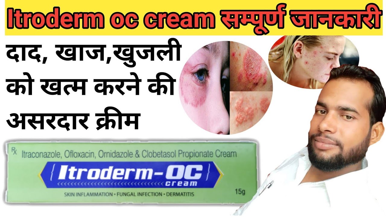 Itroderm OC cream || Itroderm OC cream uses in hindi || फंगल इन्फेक्शन ...