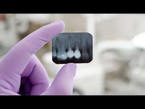 Mastering IOPA X-rays: Step-by-Step Guide for Dental Students - YouTube