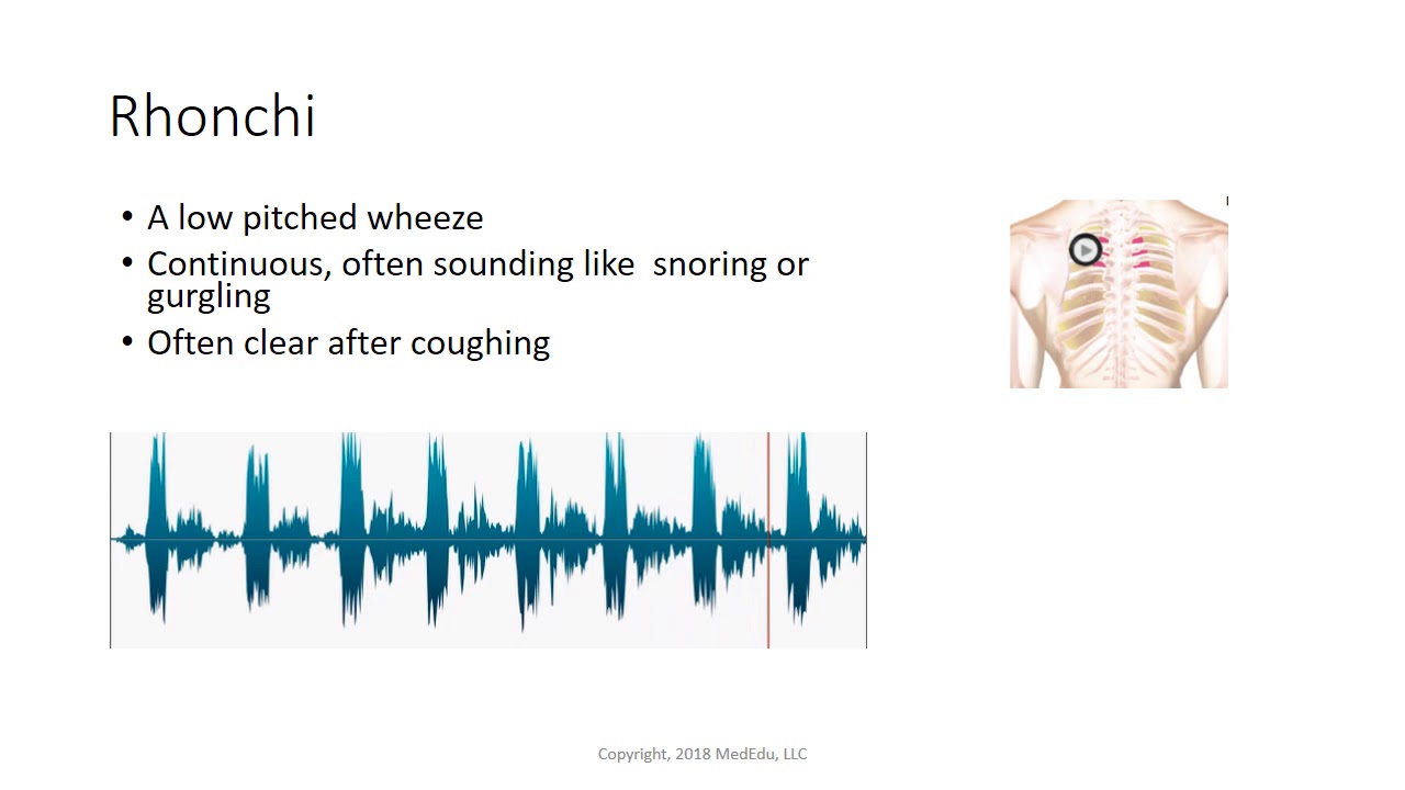 Essential LungSounds Edition 3 - YouTube