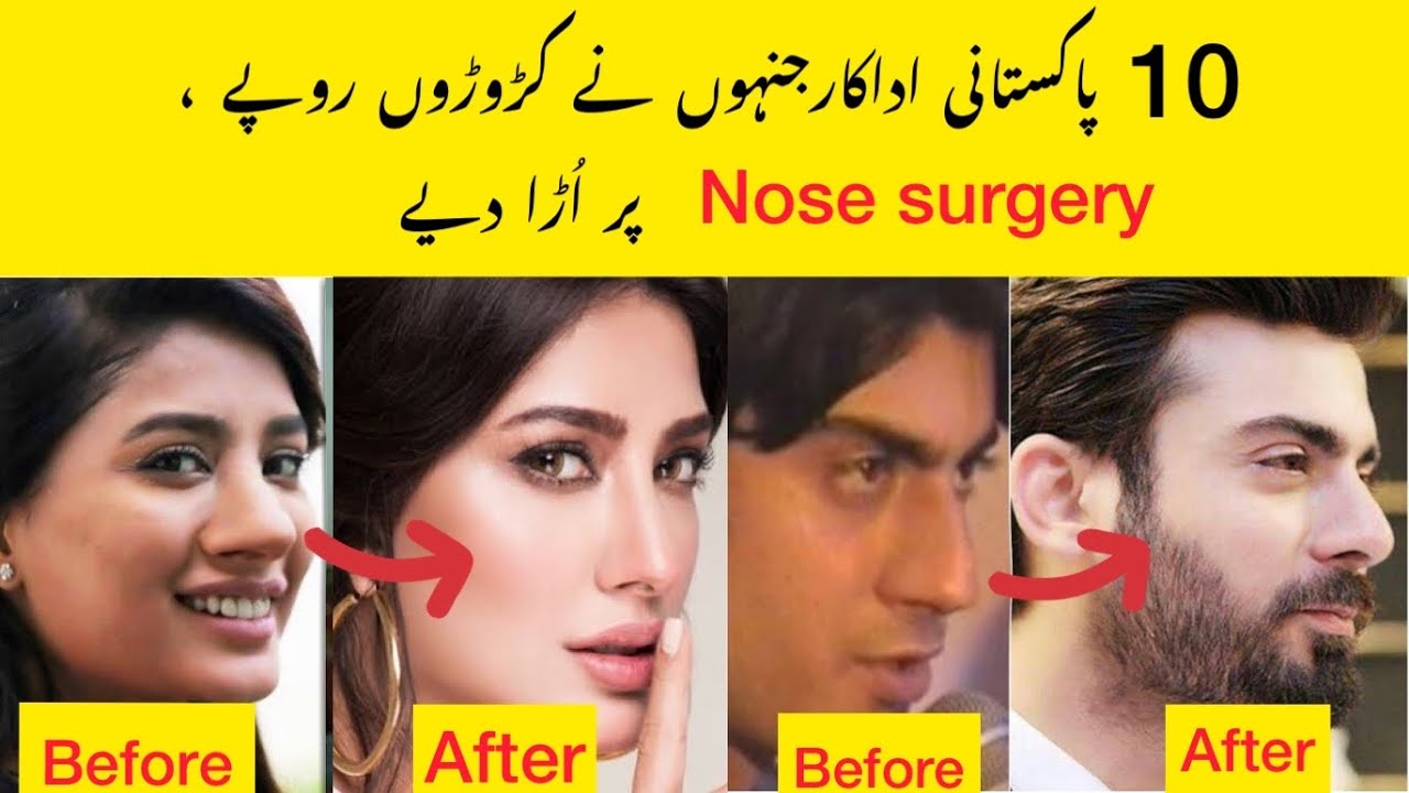 Pakistani Actors who had Nose surgery to look beautiful - YouTube