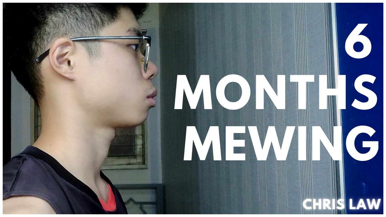 180 Days Mewing Result (Sixth Month) - YouTube