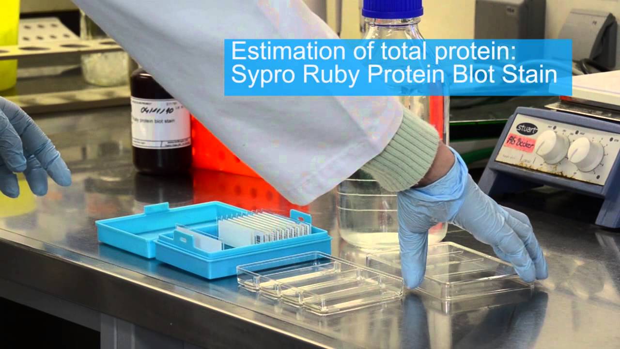 Reverse Phase Protein Array RPPA YouTube reverse-phase-protein-array-rppa-youtube