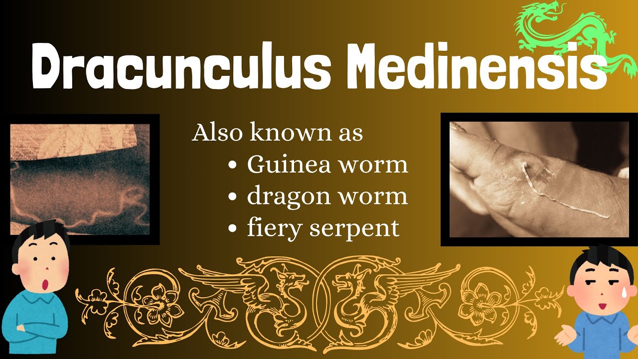 Dracunculus Medinensis(Guinea Worm): Understanding the Dragon Worm ...