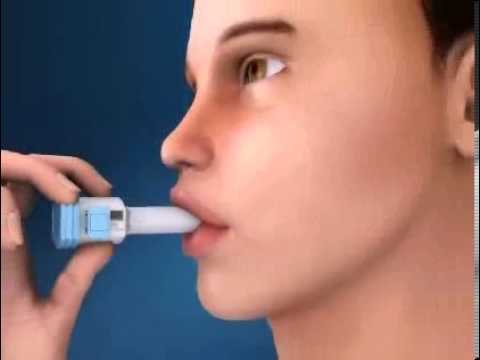 Como utilizar o Dispositivo Aerolizer - YouTube