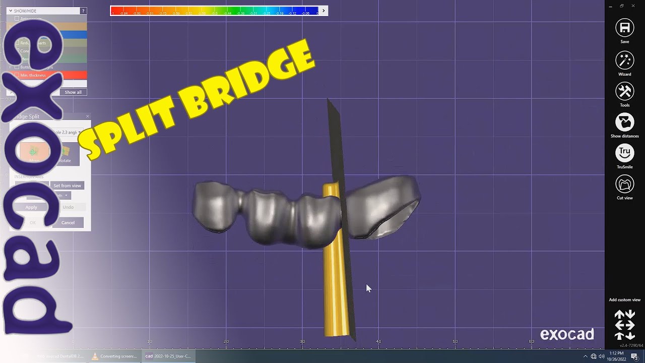 exocad split bridge - YouTube