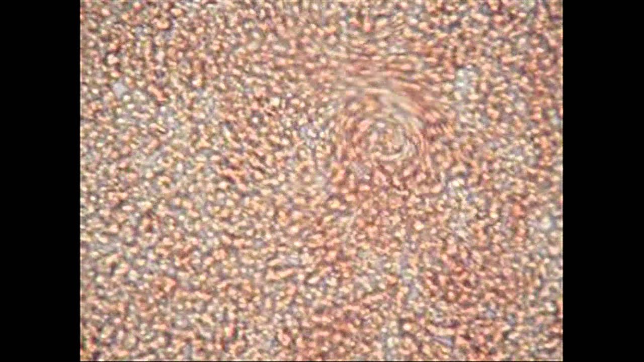 Heartworm Microfilaria