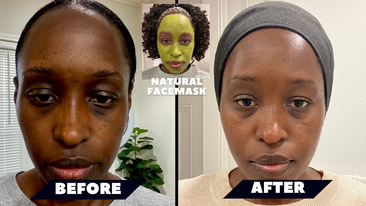 How I Faded Dark Spots with THIS Natural Face Mask! - YouTube