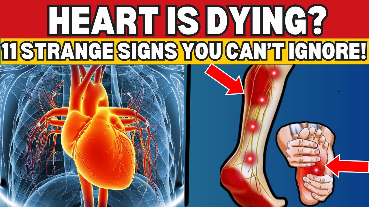 HEART IS DYING! 11 Weird Signs of HEART DAMAGE You MUST NOT Ignore ...