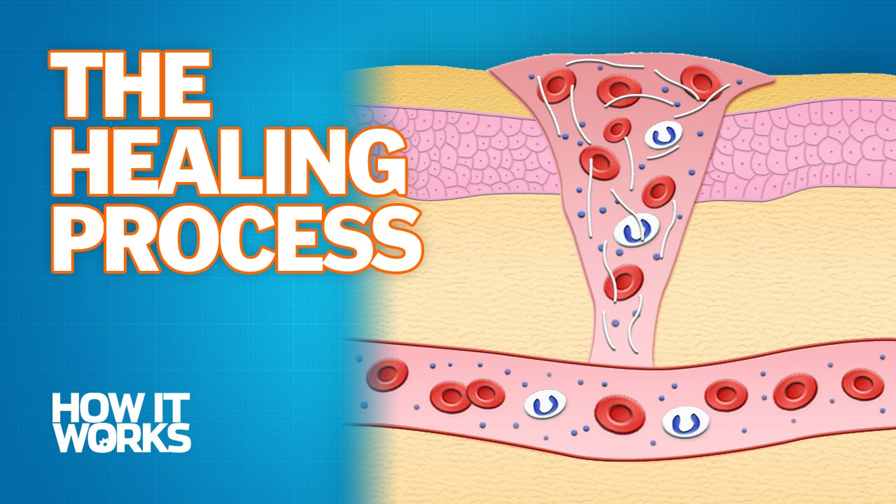 The Healing Process - in 30 secs - YouTube