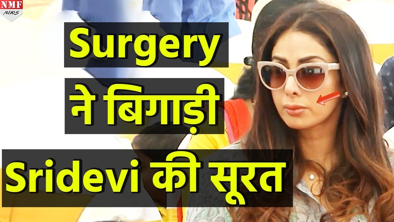 Surgery कराने के बाद Sridevi नहीं रही अब खूबसूरत|Must Watch - YouTube