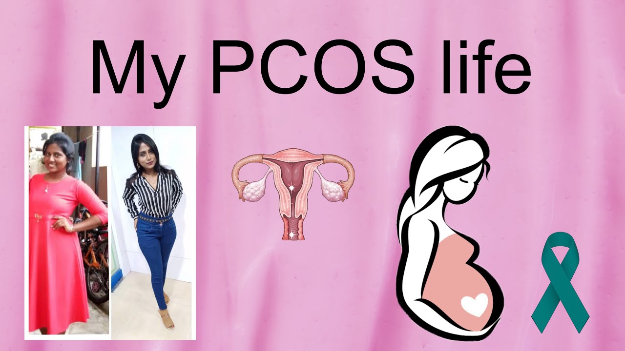 PCOD/PCOS awareness and TIPS ! My everyday life with PCOS 👧 - YouTube
