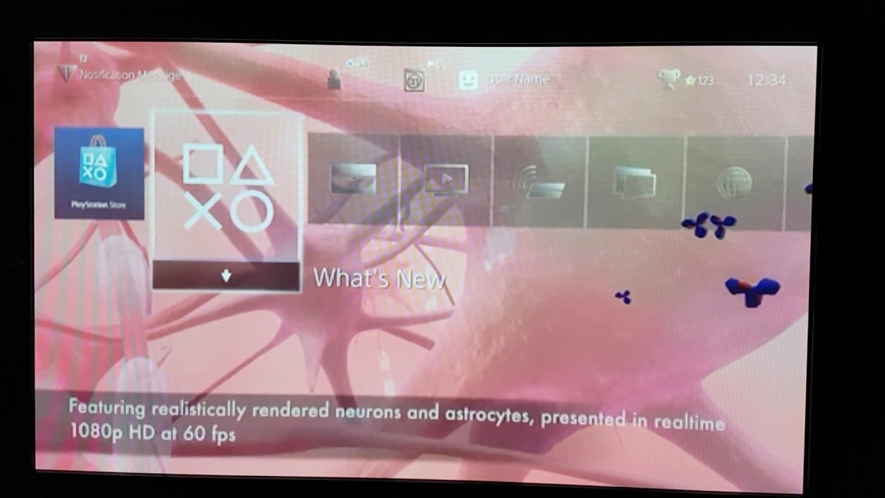 VEV Cerebrospinal Fluid Neurons Stage 4 Ps4 dynamic Theme - YouTube