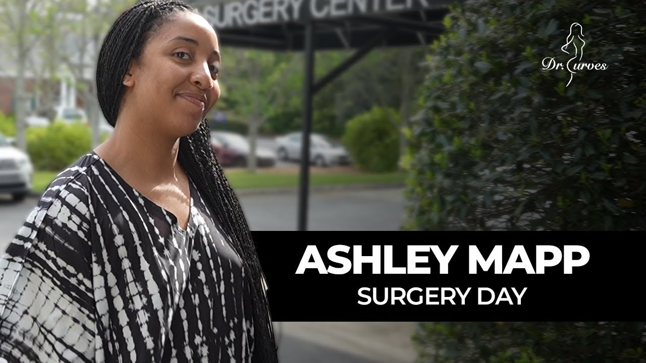 Skinny BBL Journey | Watch This Patient’s Transformation with Dr ...