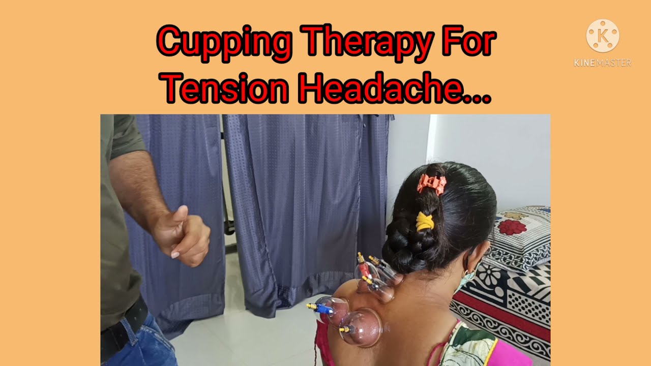 Cupping Therapy For Tension Headache | Neck Pain | Neck Stiffness ...
