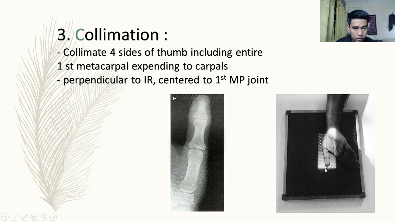 MEDICAL IMAGING 1 DBR11402 - AP THUMB PROJECTION - YouTube