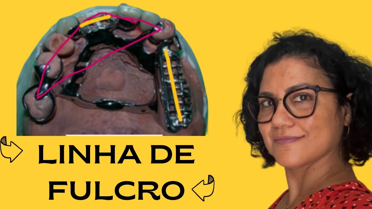 Linha de Fulcro em PPR - YouTube