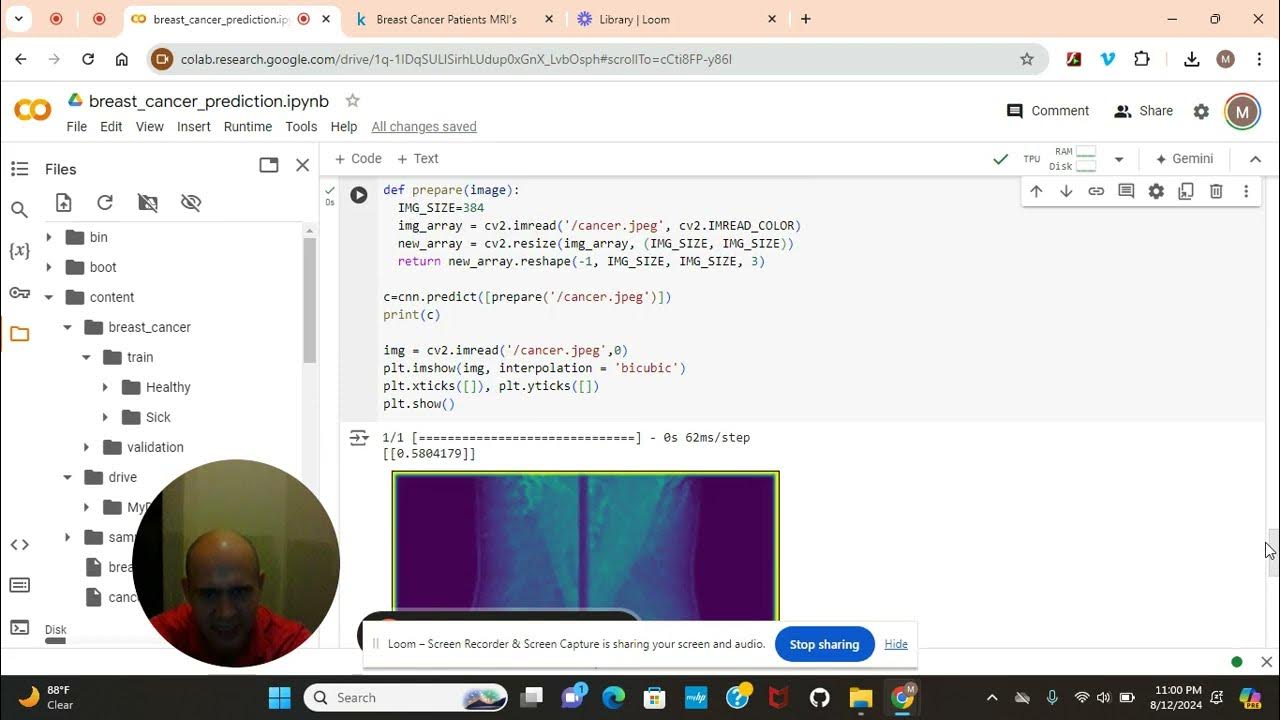 How to train a Convolutional Neural Network to detect Breast Cancer ...