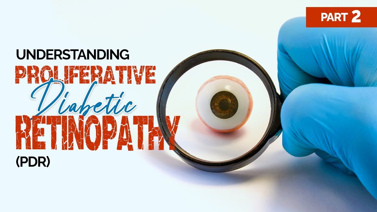 Understanding Proliferative Diabetic Retinopathy (PDR) - Part 2 - YouTube