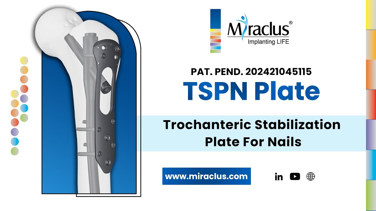 Trochanteric Stabilization Plate for Nails (TSPN) - Features - YouTube