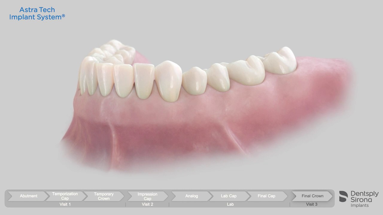 Acuris – conometric concept animation showing the step by step single ...
