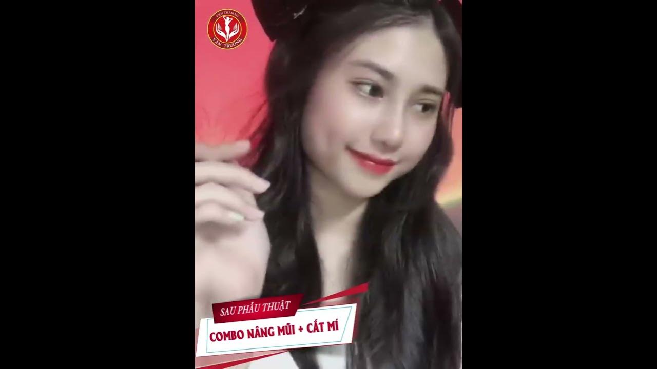 CÂu ChuyỆn HẰng NgÀy TẠi ViỆn ThẨm MỸ VĂn TrƯỜng Youtube