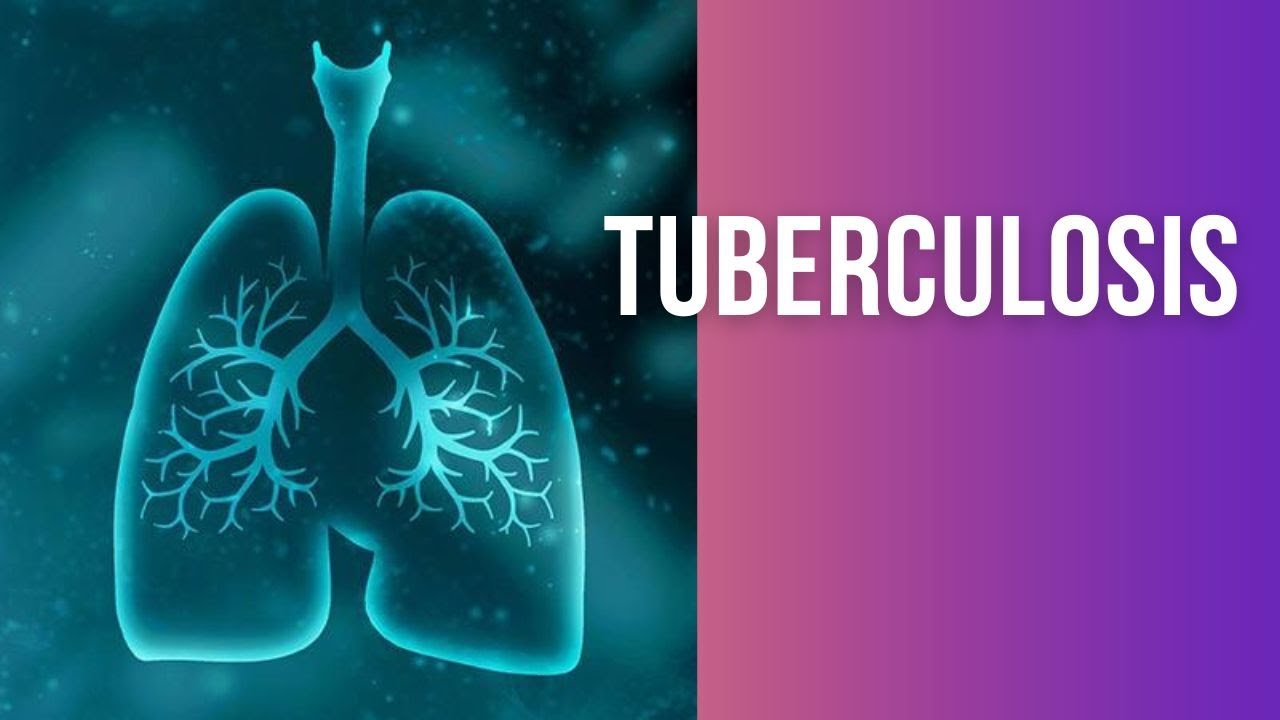 Tuberculosis Part 01 - YouTube