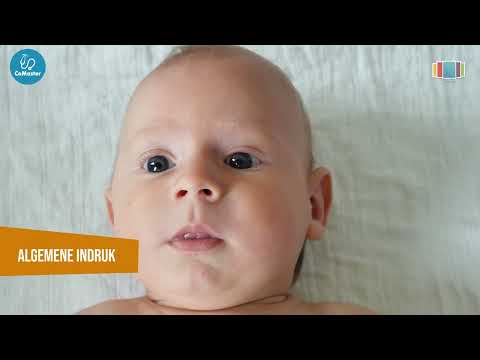 CoMaster - Lichamelijk Onderzoek Neonaat (Deel 1)
